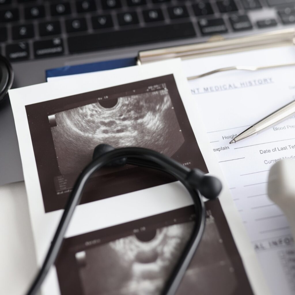 Saline Infusion Sonohysterogram (SHG) | Fertility Test